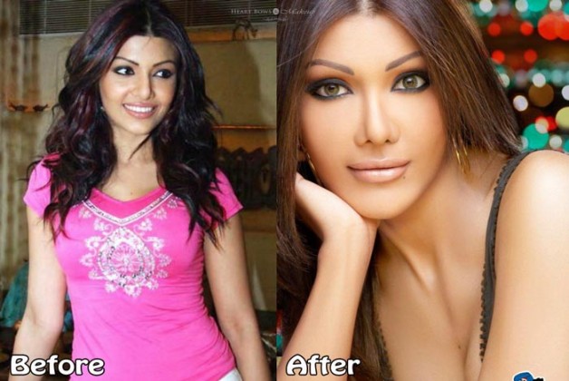 Top 10 Bollywood Plastic Surgeries Disasters: Before & After! - Heart ...